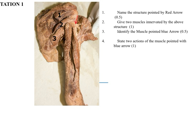 Solved TATION 1Name the structure pointed by Red Arrow | Chegg.com