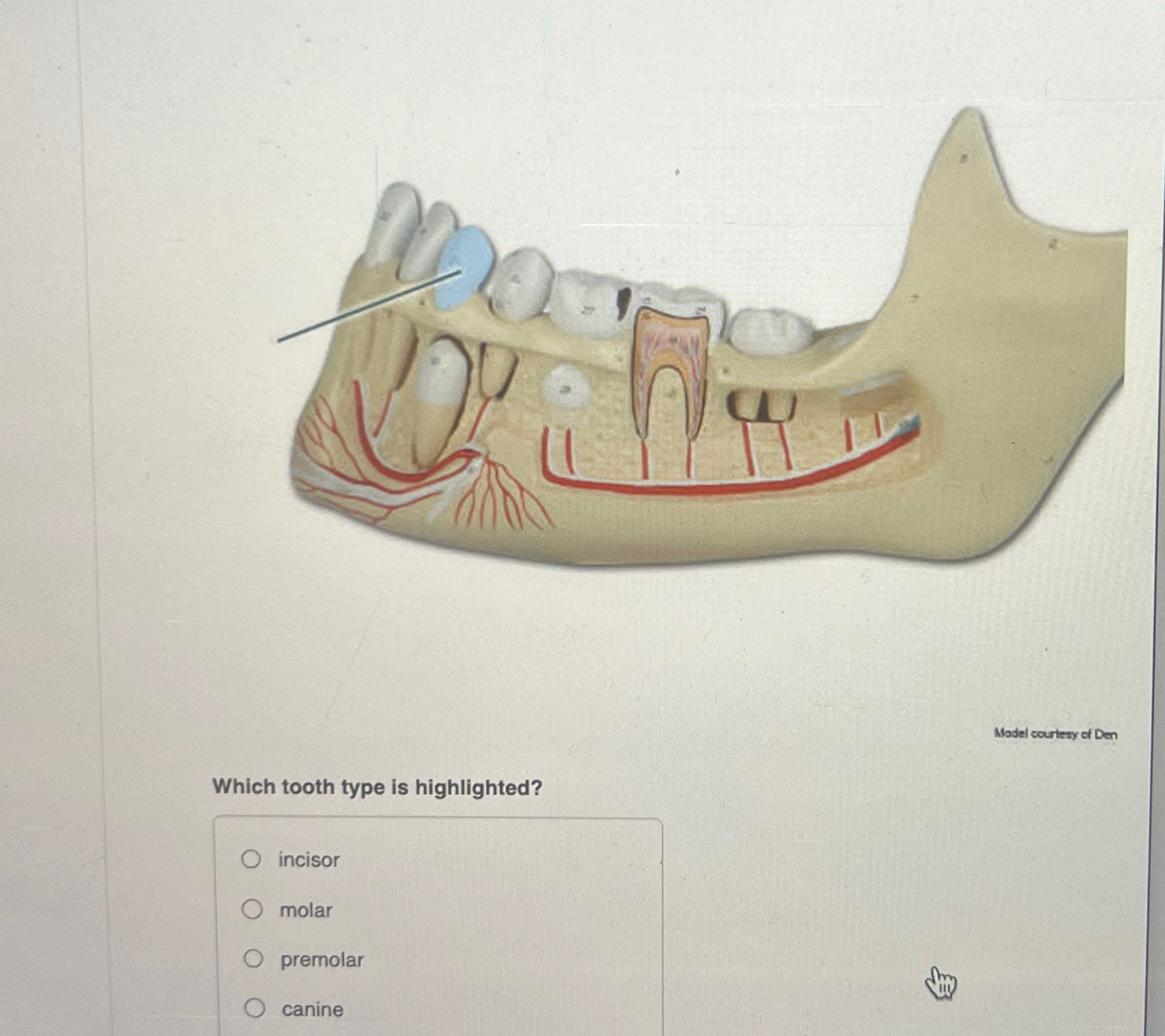 Solved Madel courtesy of DenWhich tooth type is | Chegg.com