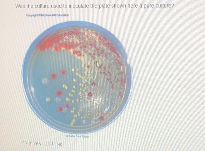 Solved Selection with Pseudomonas aeruginosa this TSA slant | Chegg.com