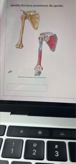 Solved Identify this bony prominence. Be specific. 1 72 2 #3 | Chegg.com