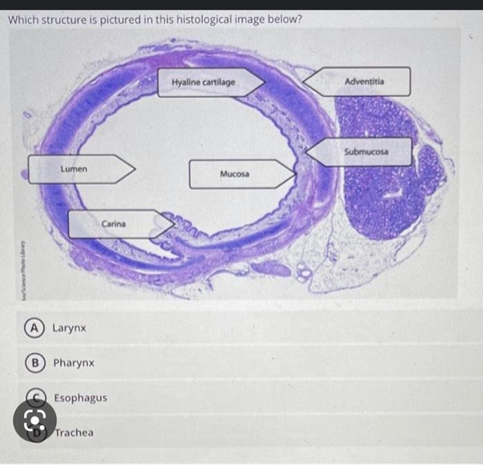 Solved define the terms perlstasls and segmentation. where | Chegg.com