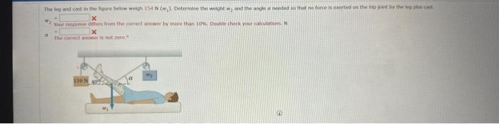 Solved The leg and cast in the figure below weigh 154 N | Chegg.com