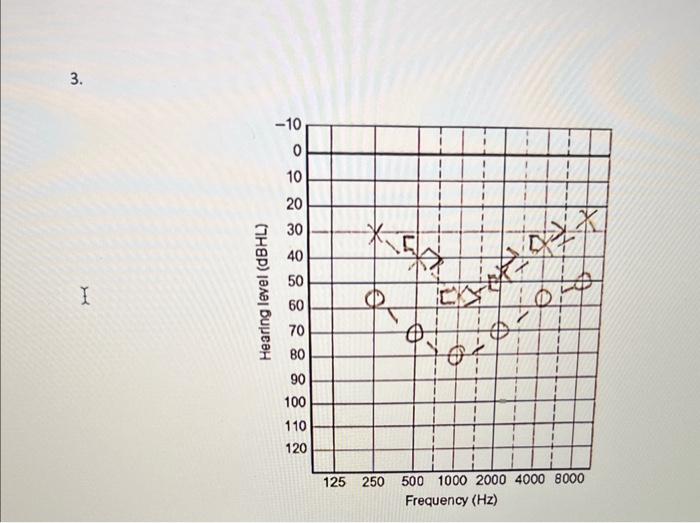Solved Instructions: Interpret the audiograms below and | Chegg.com