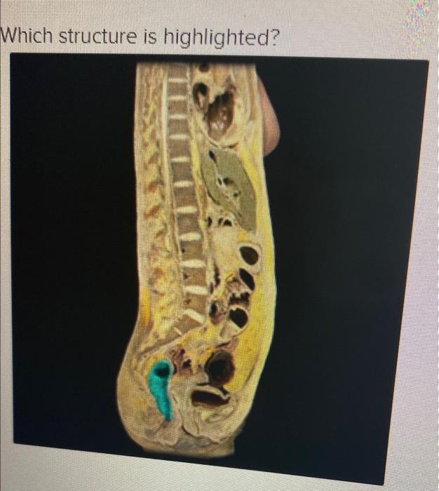 Solved Which structure is highlighted? O jejunum | Chegg.com