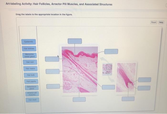 Solved Art-labeling Activity: Hair Follicles, Arrector Pili | Chegg.com