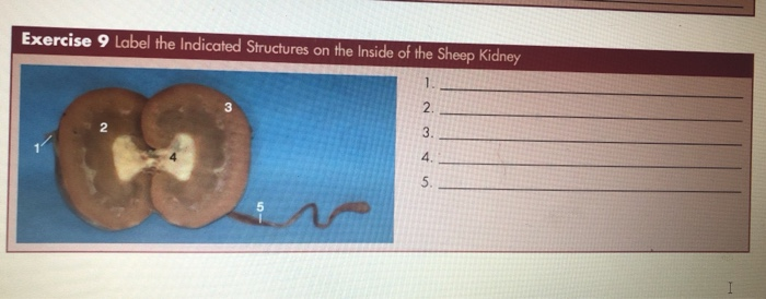 Solved Exercise 9 Label the Indicated Structures on the | Chegg.com