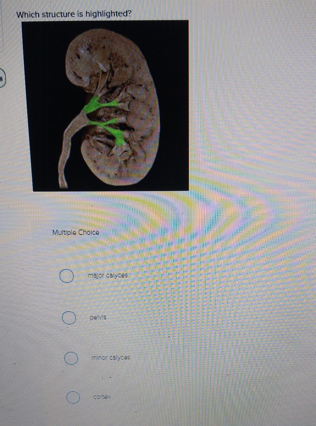 Solved Which structure is highlighted? Multiple Cholce renal | Chegg.com