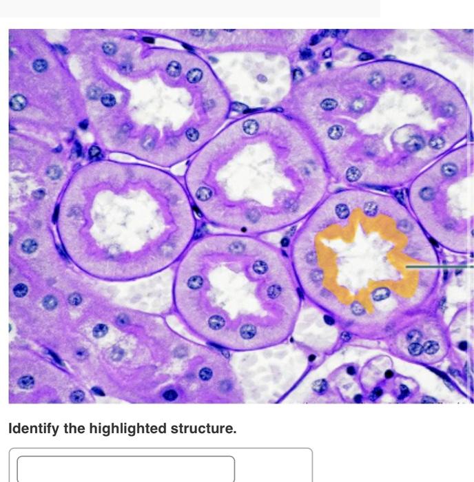 Solved Identify the highlighted structure.Identify the | Chegg.com