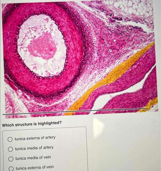 [Solved]: Which structure is highlighted? O tunica externa o