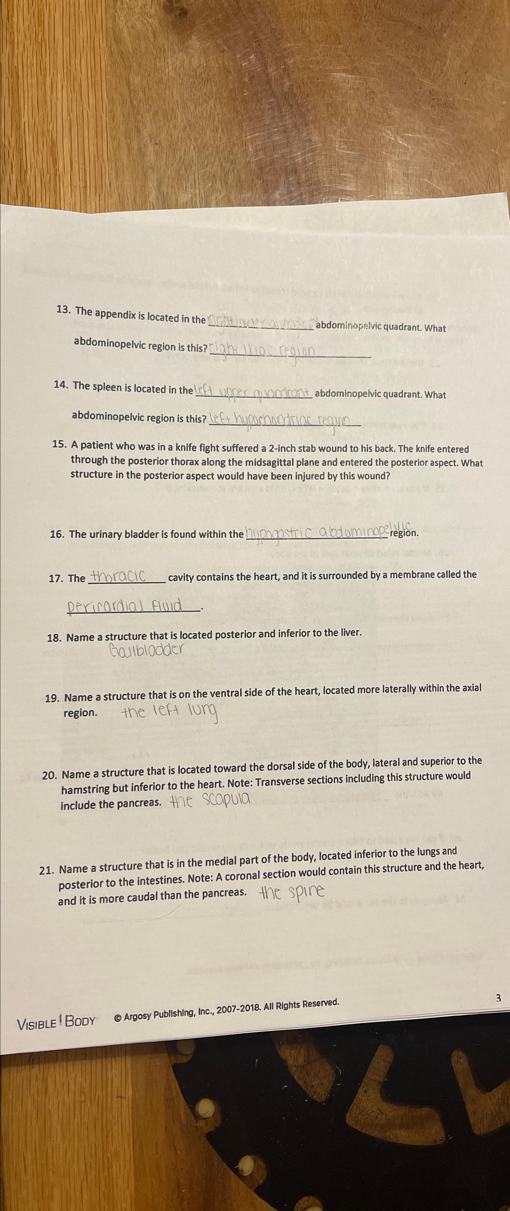 Solved The appendix is located in the abdominopelvic region | Chegg.com