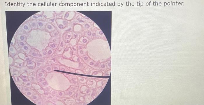 Solved Identify the cellular component indicated by the tip | Chegg.com