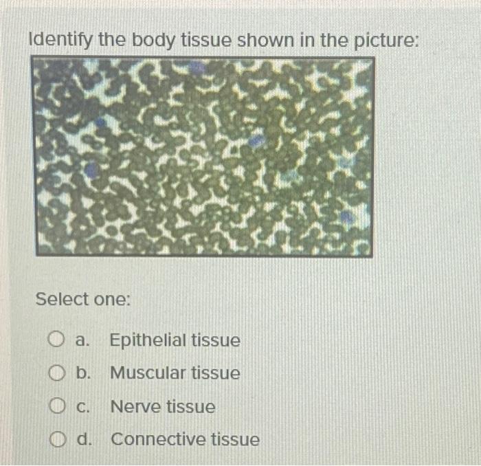Identify the body tissue shown in the picture: Select | Chegg.com