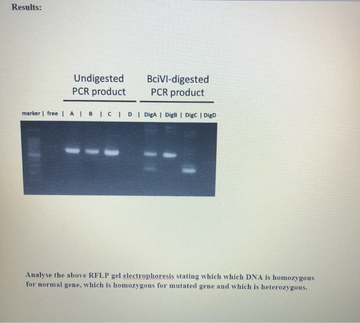 Solved Results: Undigested PCR product Bcill-digested PCR | Chegg.com