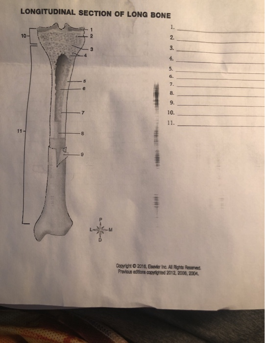 Solved LONGITUDINAL SECTION OF LONG BONE - No Copyright | Chegg.com