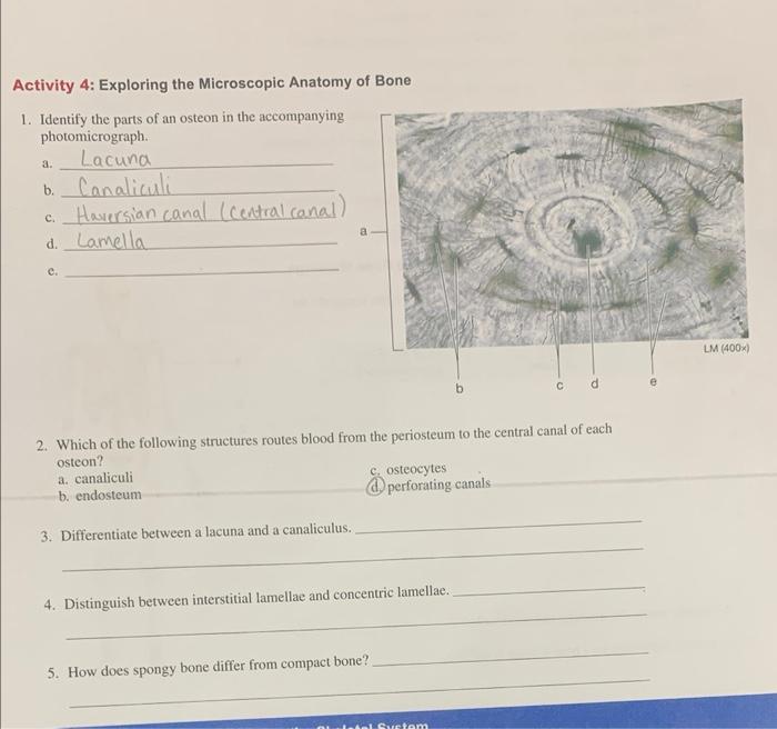 Solved Activity 4: Exploring the Microscopic Anatomy of Bone | Chegg.com