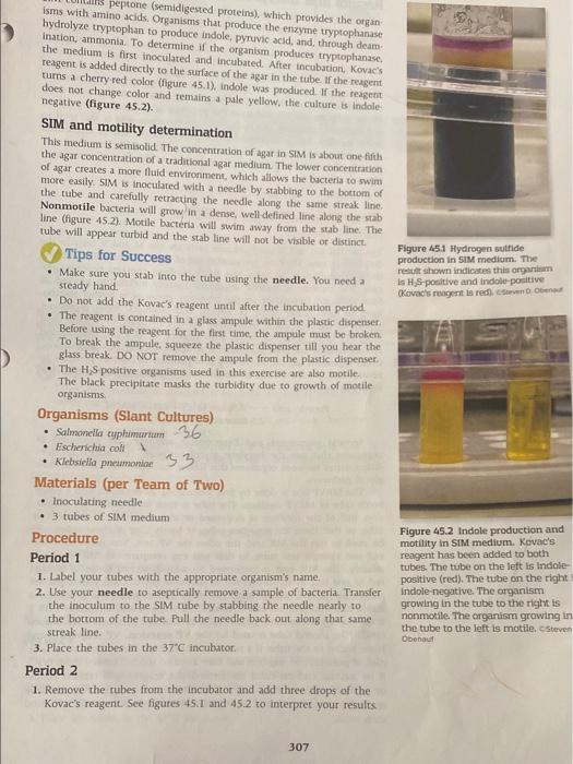 IMViC (Indole, Methyl Red, VogesProskauer, Citrate) | Chegg.com