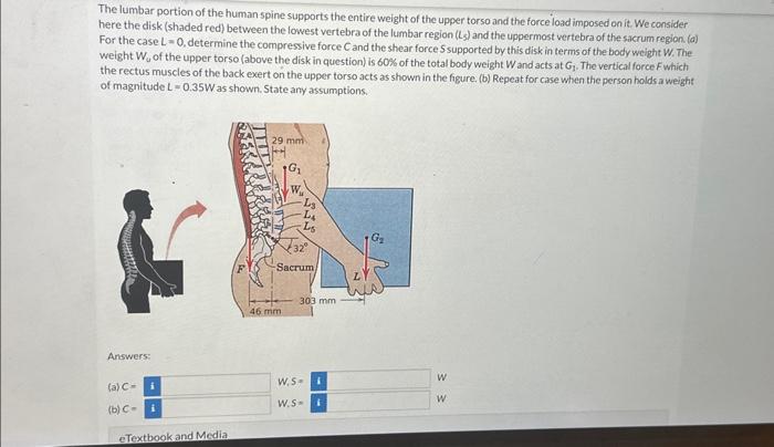 Solved The lumbar portion of the human spine supports the | Chegg.com