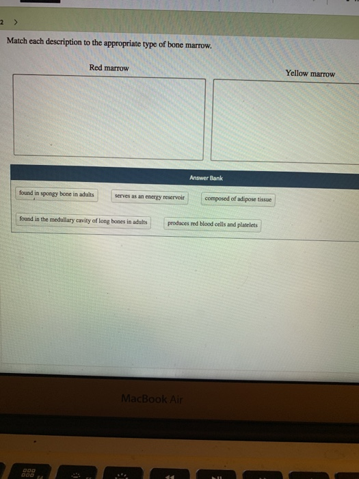 Solved Match each description to the appropriate type of | Chegg.com