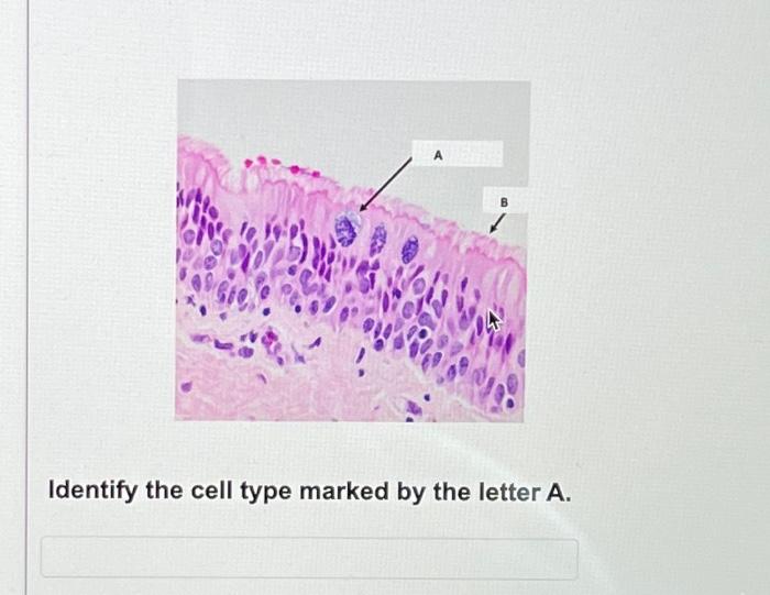 Solved Identify the cell type marked by the letter A. | Chegg.com