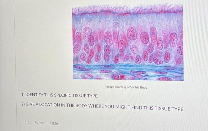 Solved *Image courtesy of Visible Body 1) IDENTIFY THE | Chegg.com