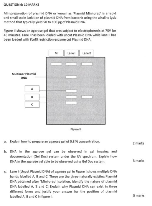 Solved QUESTION 6: 10 MARKS Minipreparation of plasmid DNA | Chegg.com