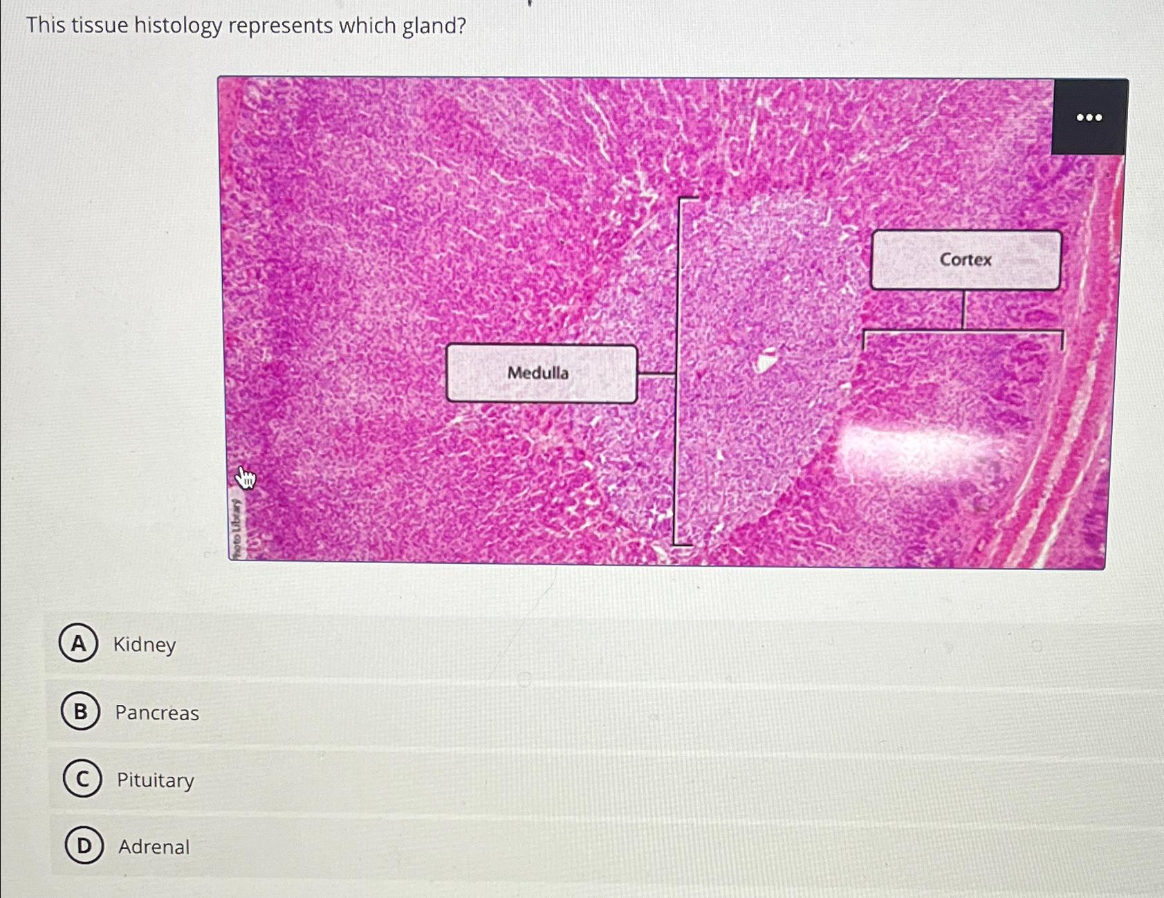 Solved This tissue histology represents which | Chegg.com