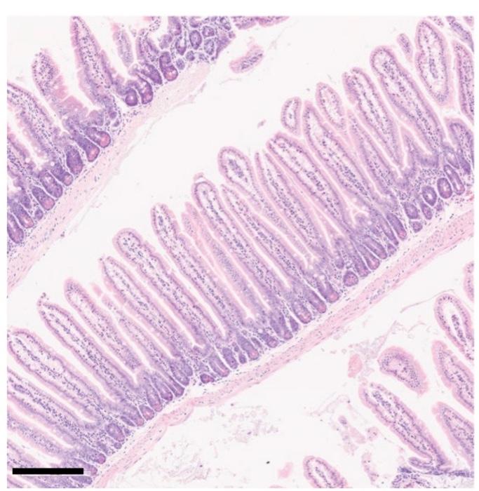 Solved they used H&E staining in this duodenumusing the | Chegg.com