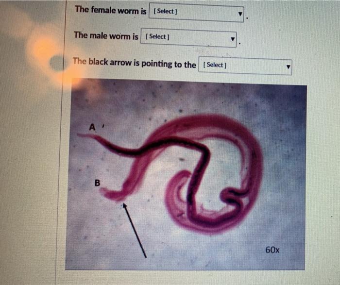 Solved An acid fast bacterium stains a Select color and a | Chegg.com