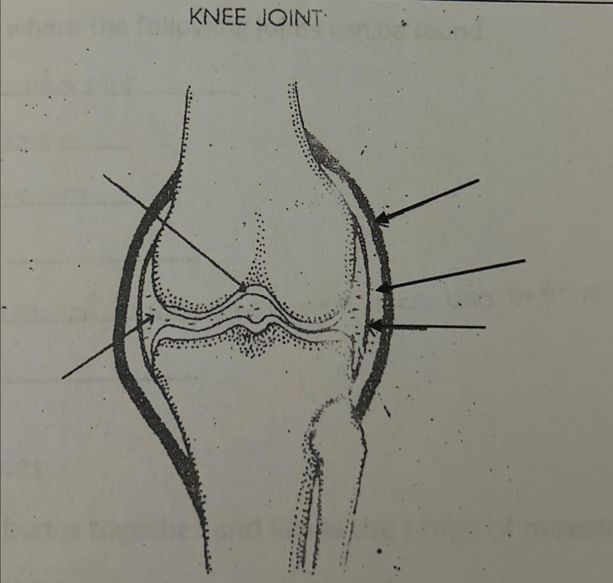 Solved KNEE JOINT.Label the diagram | Chegg.com