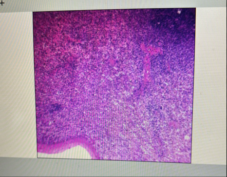 Photo 3: spleen Label the red pulp, white pulp, and | Chegg.com