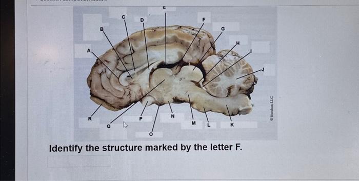 Identify the structure marked by the letter F. | Chegg.com