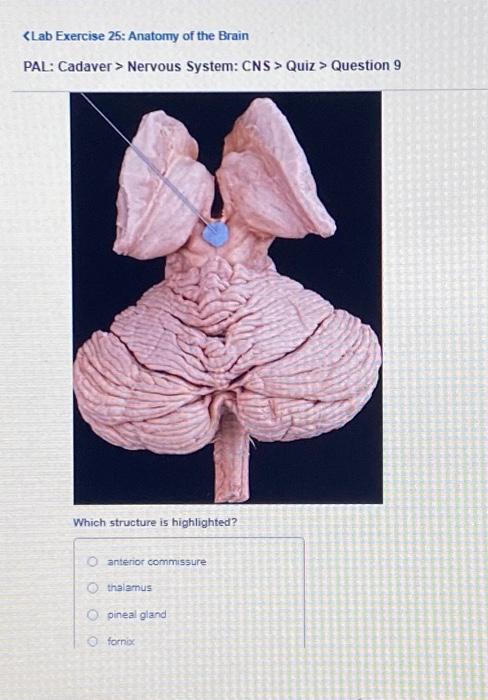 Solved Nervous System: CNS > Quiz > Question 19 Which | Chegg.com