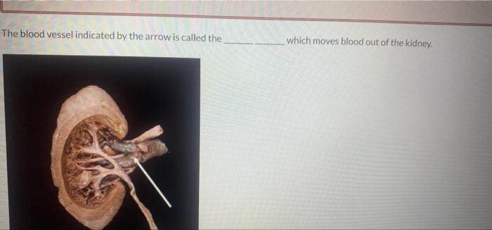 Solved The location of the organs indicated by the arrows is | Chegg.com