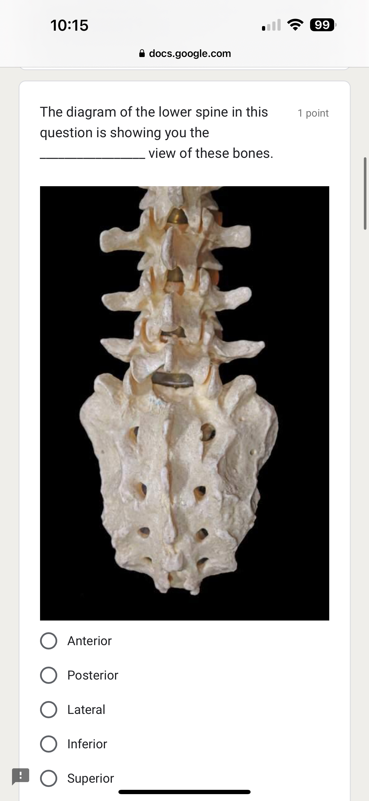 Solved 10:15docs.google.comThe diagram of the lower spine in | Chegg.com