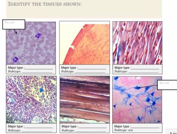 Solved IDENTIFY THE TISSUES SHOWN: Major type Subtypes Major | Chegg.com