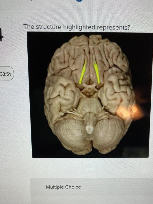Solved The structure highlighted represents? 33:51 Multiple | Chegg.com