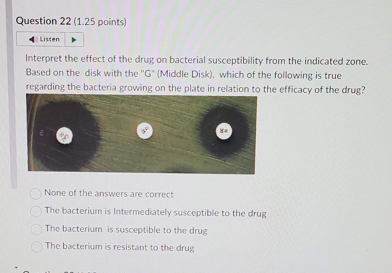 Solved Did not primary stain long enough Under-Decolorized | Chegg.com