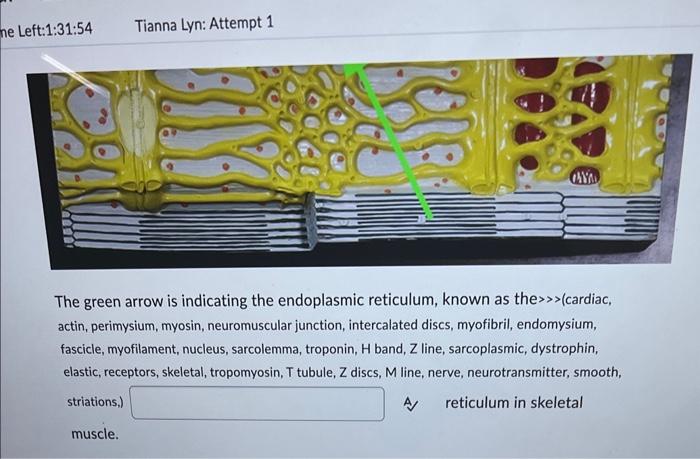 Solved The green arrow is indicating the endoplasmic | Chegg.com