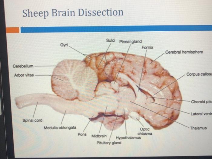 Solved Sheep Brain Dissection Sheep brain: lateral view, | Chegg.com