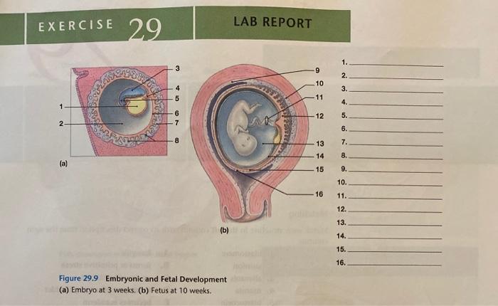 Solved Label the anatomy of the embryo and fetus in Figure | Chegg.com