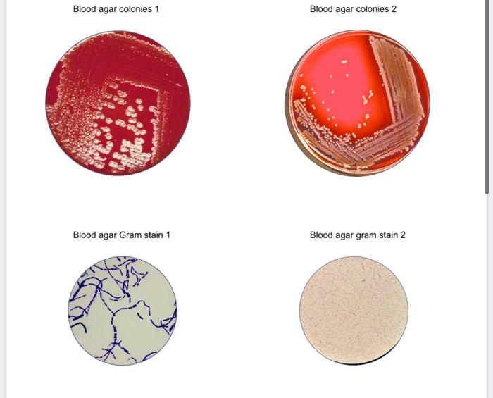 Solved Blood agar colonies 1 Blood agar colonies 2 Blood | Chegg.com