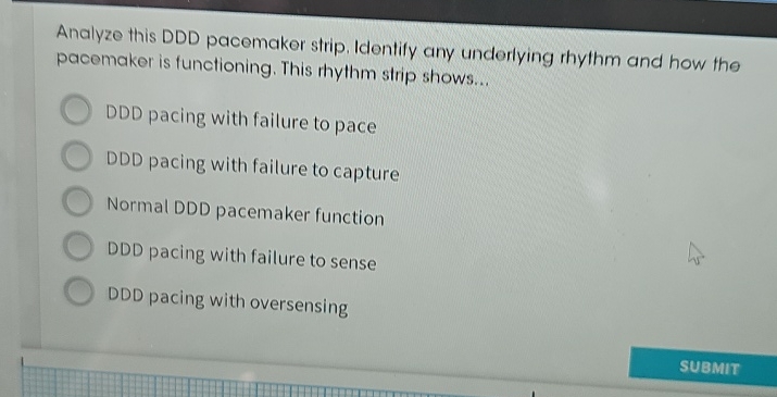 Solved Analyze this DDD pacemaker strip. Identify any | Chegg.com