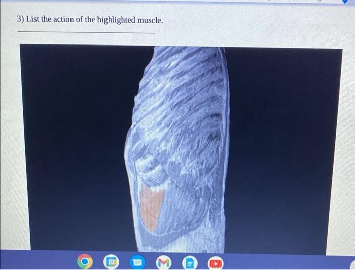 Solved 3) List the action of the highlighted muscle. | Chegg.com