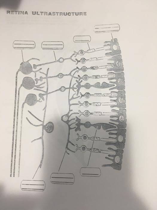 Solved RETINA ULTRASTRUCTURE DONE CILIARY MUSCLES For near | Chegg.com