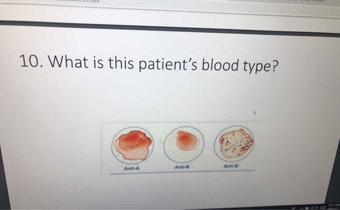Solved 10. What is this patient's blood type? | Chegg.com