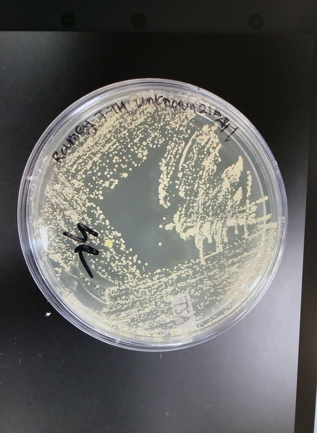 what are the broth and colony characteristics for | Chegg.com
