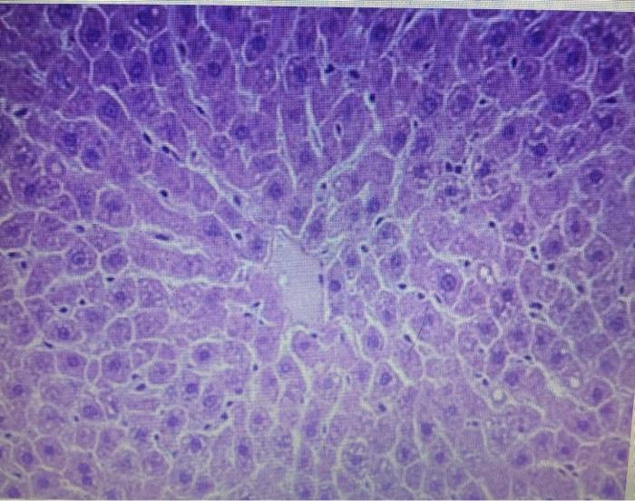 Solved need help with pathology question:Normal | Chegg.com Solved need help with pathology question:Normal | Chegg.com