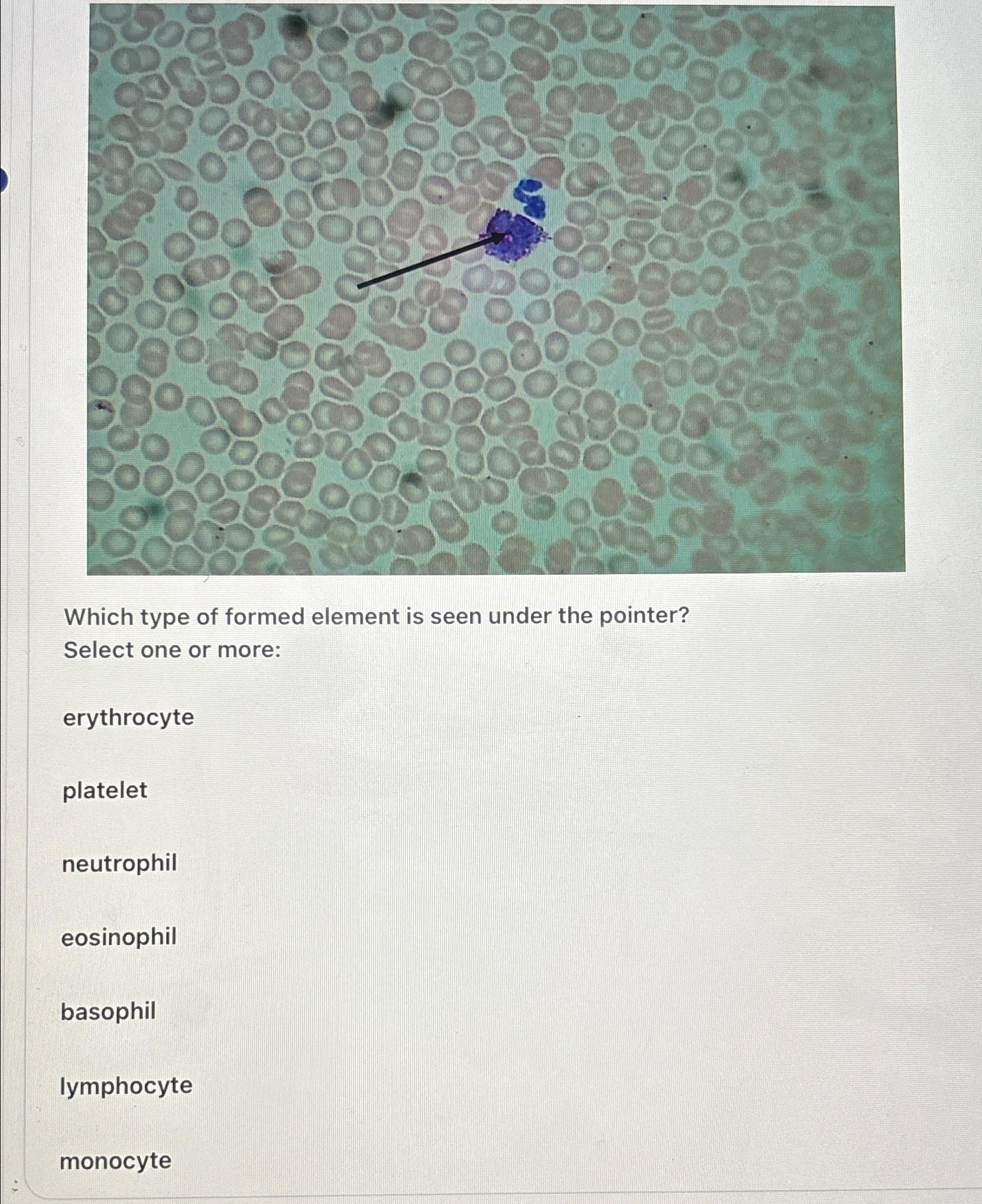 Solved Which type of formed element is seen under the | Chegg.com