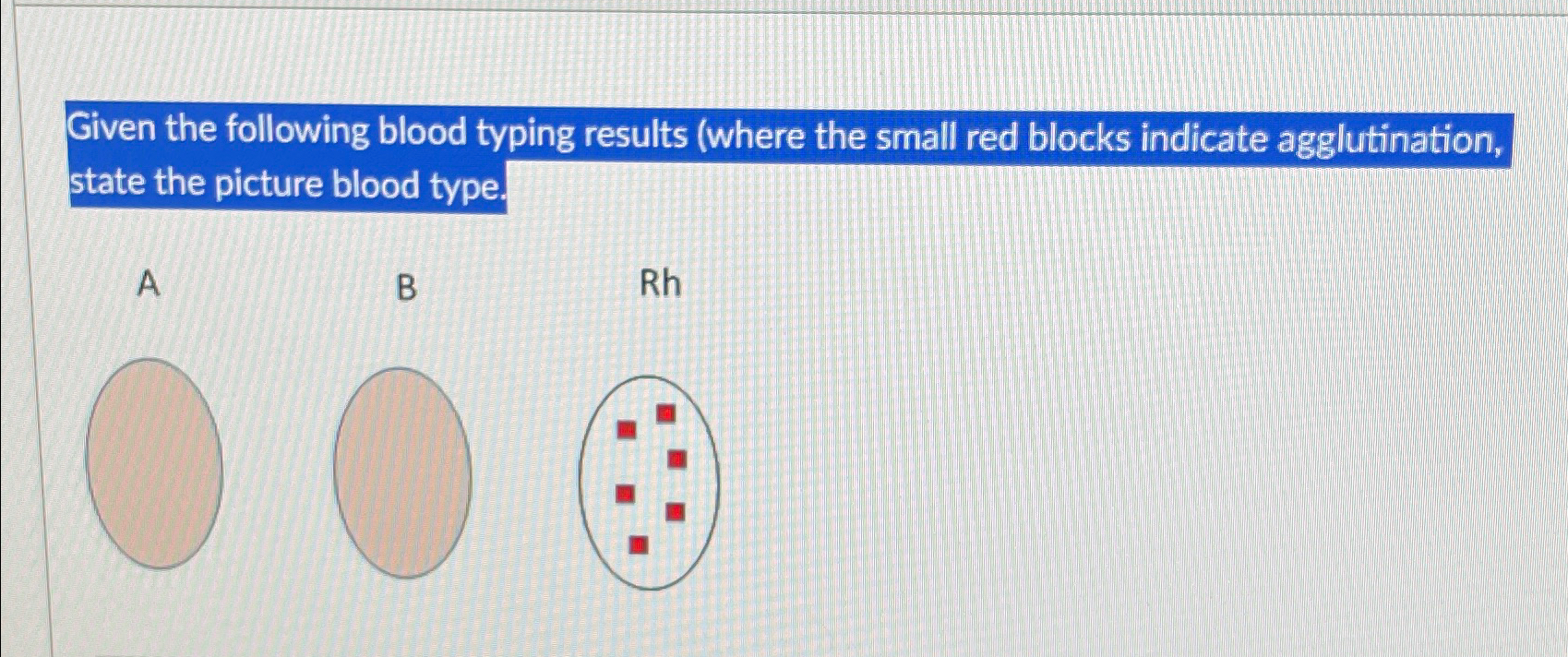 Solved Given the following blood typing results (where the | Chegg.com