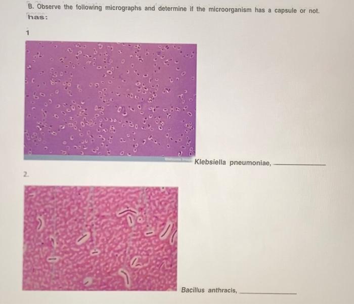 Solved B. Observe the following micrographs and determine if | Chegg.com Solved B. Observe the following micrographs and determine if | Chegg.com